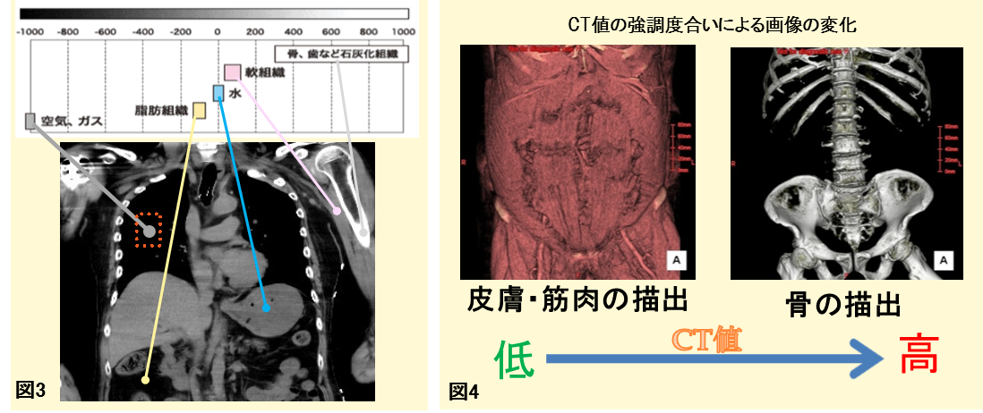 CT – ページ 2 – Radiology@Home