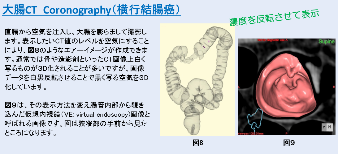 3DCT画像とその成り立ちについて – Radiology@Home