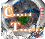3DCT画像とその成り立ちについて – Radiology@Home