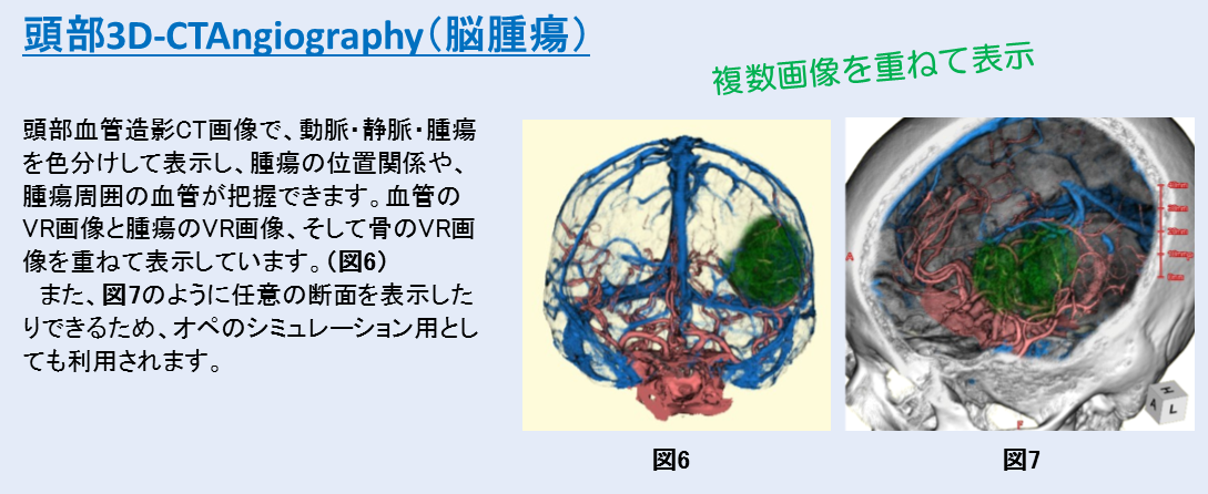3DCT画像とその成り立ちについて – Radiology@Home