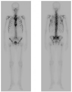 bone – Radiology@Home
