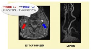MRI – Radiology@Home
